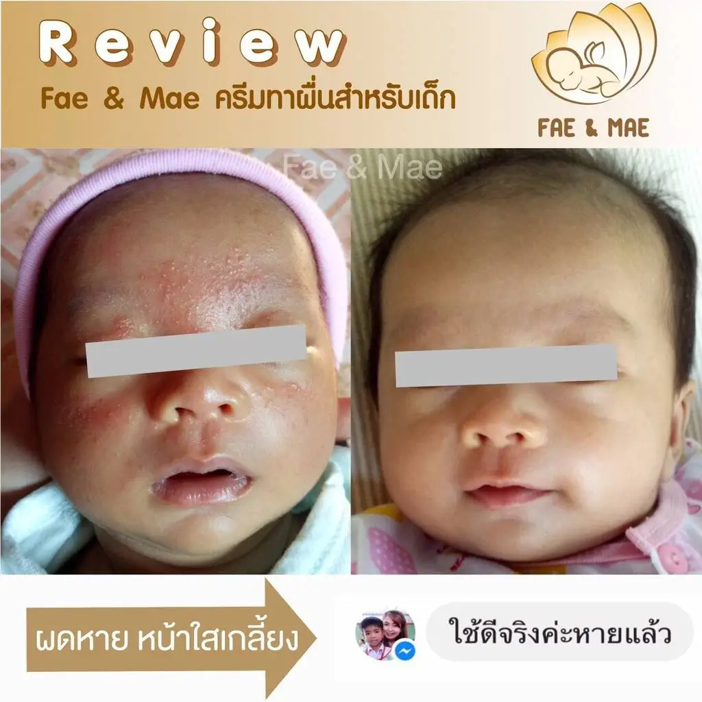Fae&Mae Organic Baby Cream ครีมทาผดผื่นเด็ก เฟ แอนด์ เม ใช้ได้ตั้งแต่แรกเกิด ไม่มีกลิ่น_40 ...